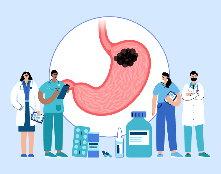 Stomaku | Klinika Kajo | Klinike Mjekesore ne Tirane