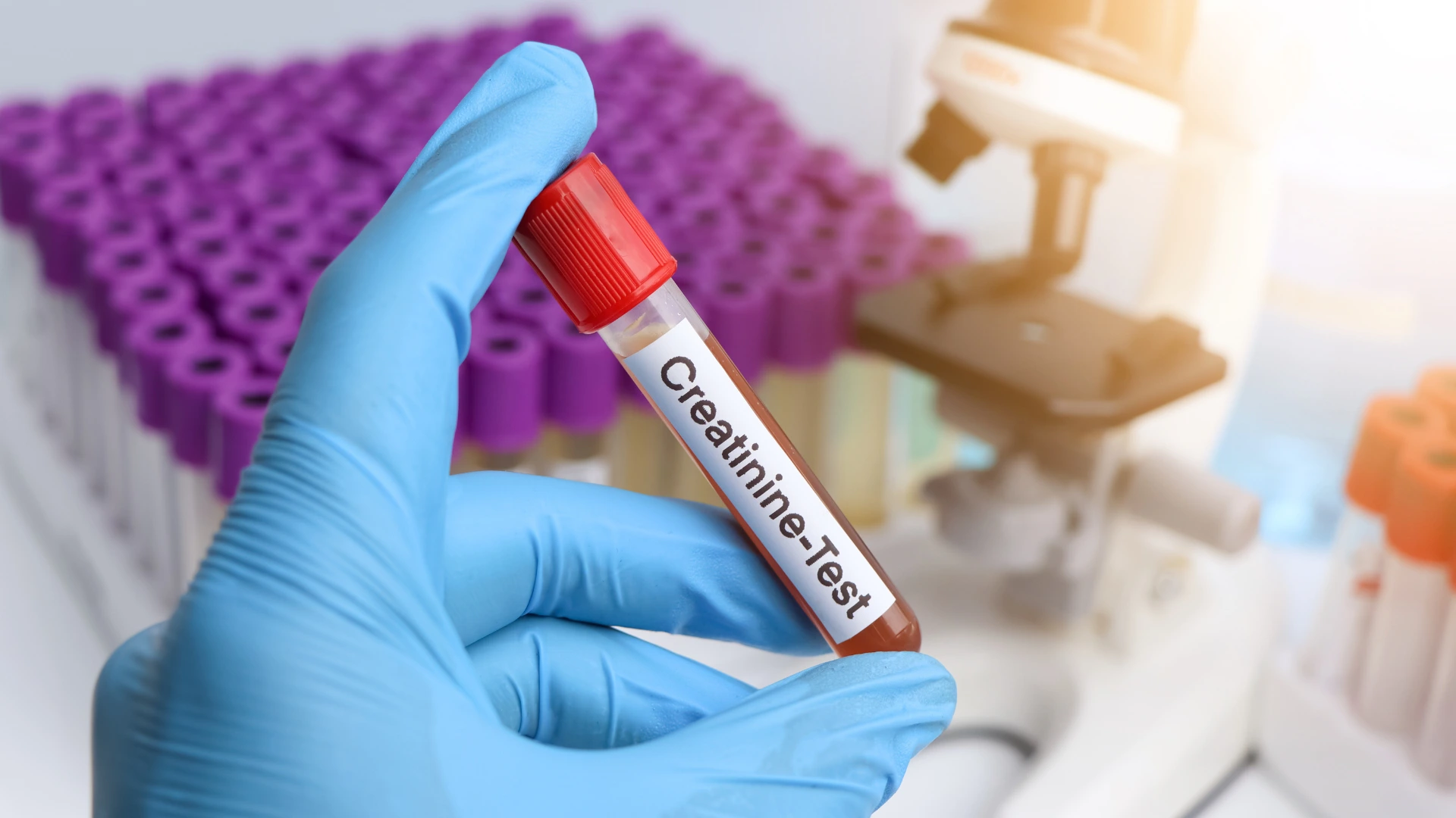 Creatinine Test | Kidney Function & Health Screening 🌿