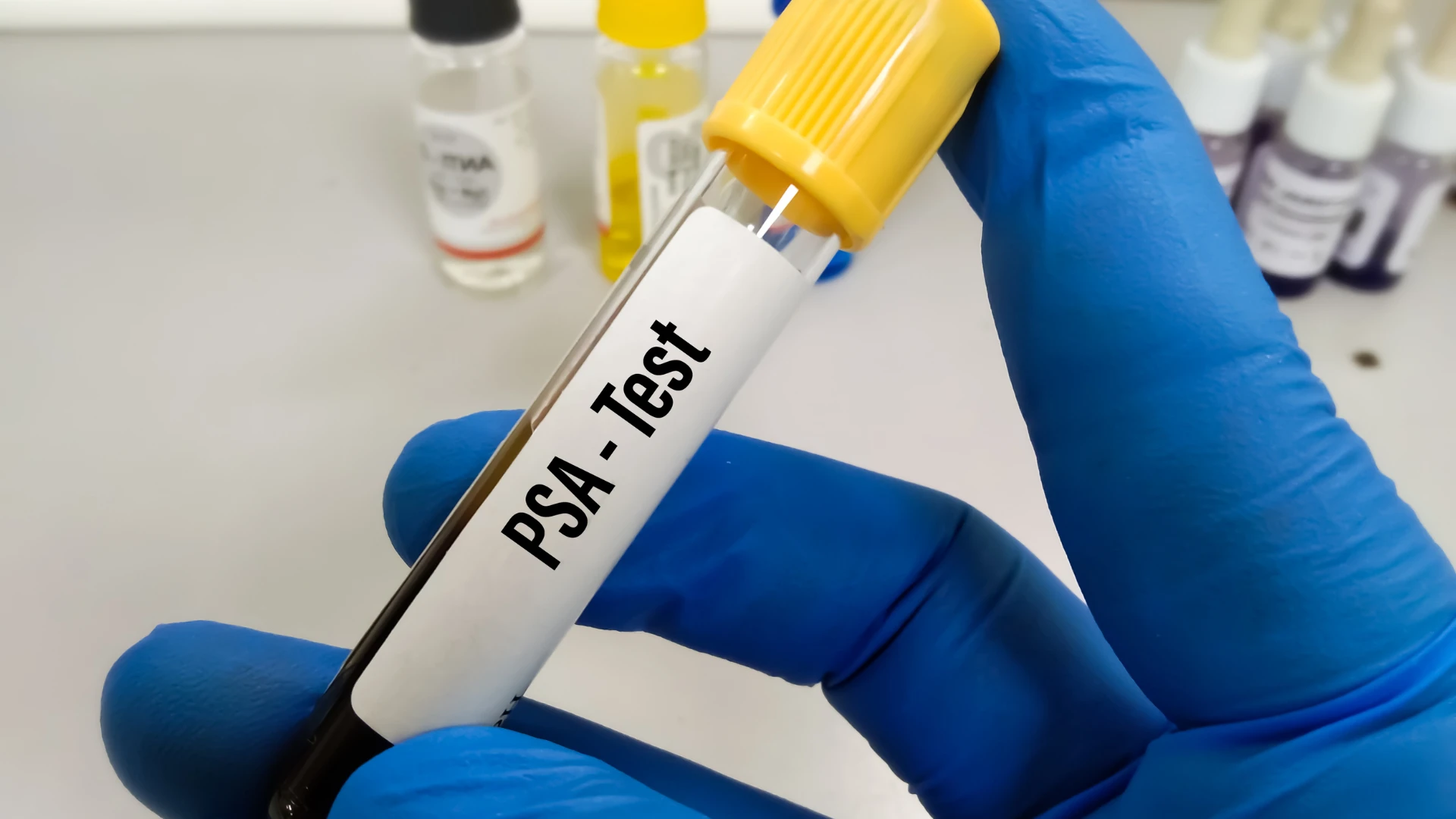 PSA & Free PSA Test | Prostate Health & Cancer Screening 💦