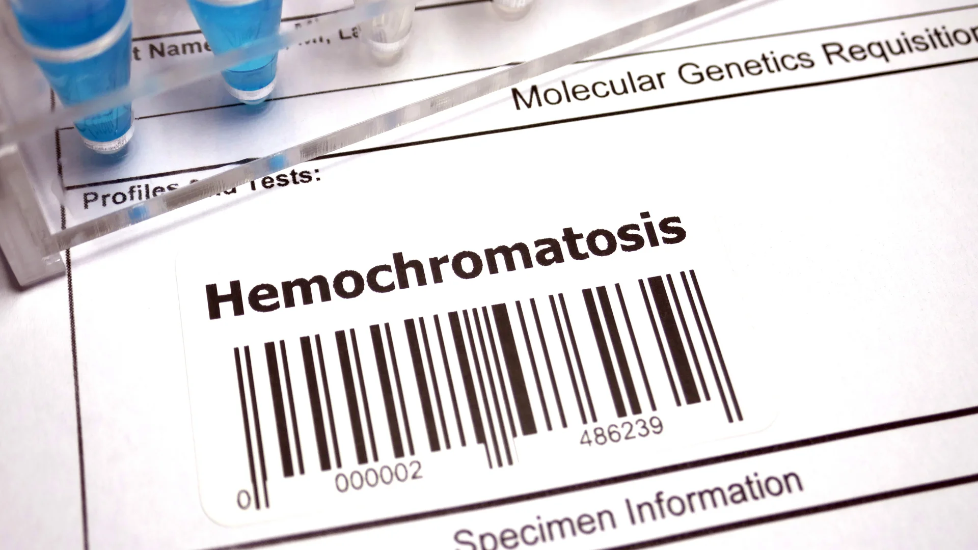 Hemochromatosis | Causes, Symptoms & Treatment for Iron Overload 🔩